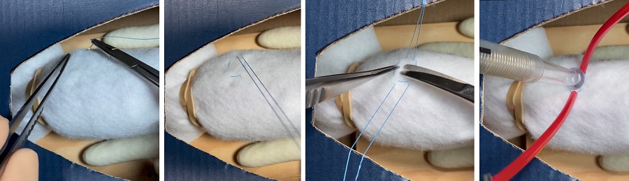 Cardiac surgery simulation – Part 2: Cannulation | MMCTS