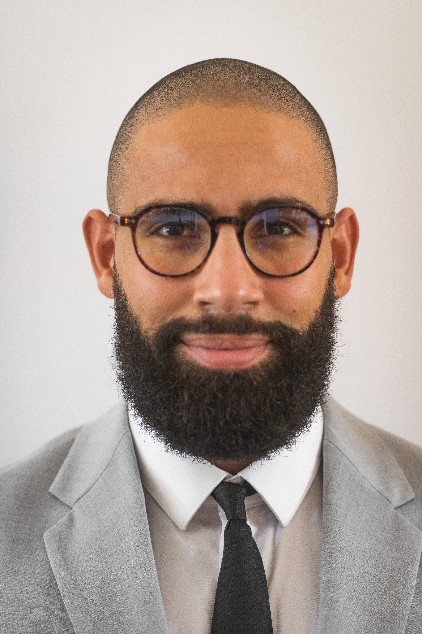 Transatrial repair of a ventricular septal defect and tricuspid valve ...