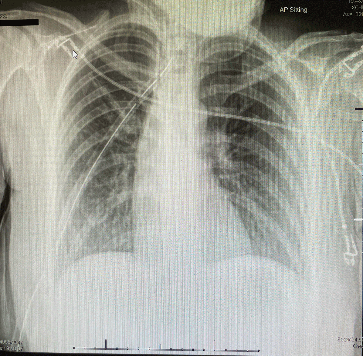 The role of 3-dimensional reconstruction imaging in bronchopulmonary ...