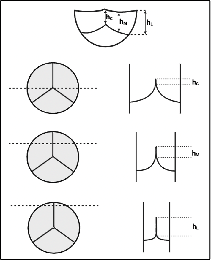 Striving for physiologic coaptation: An experimental and innovative ...