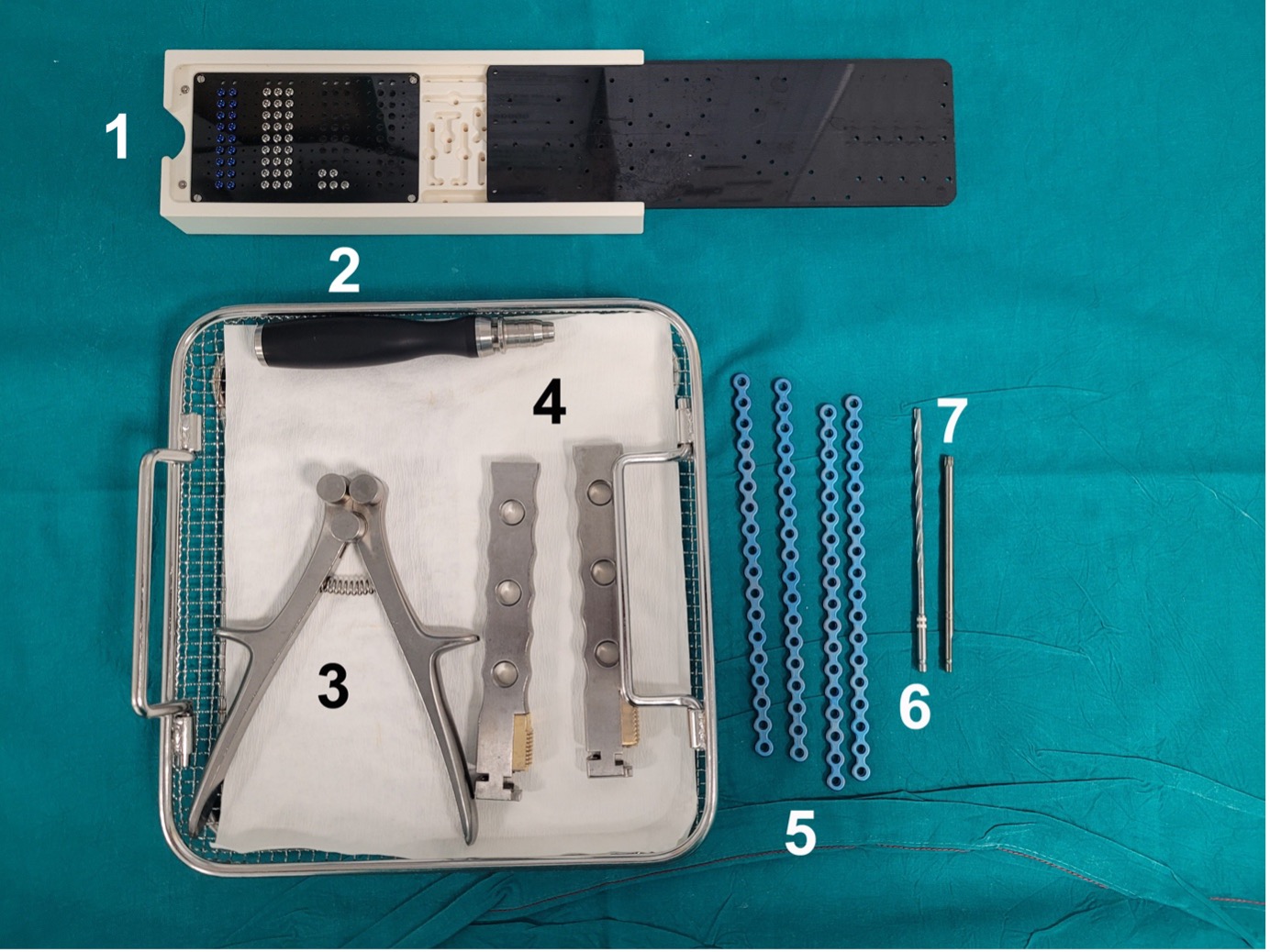 Brixia system of screws: a titanium modular system with wide ...