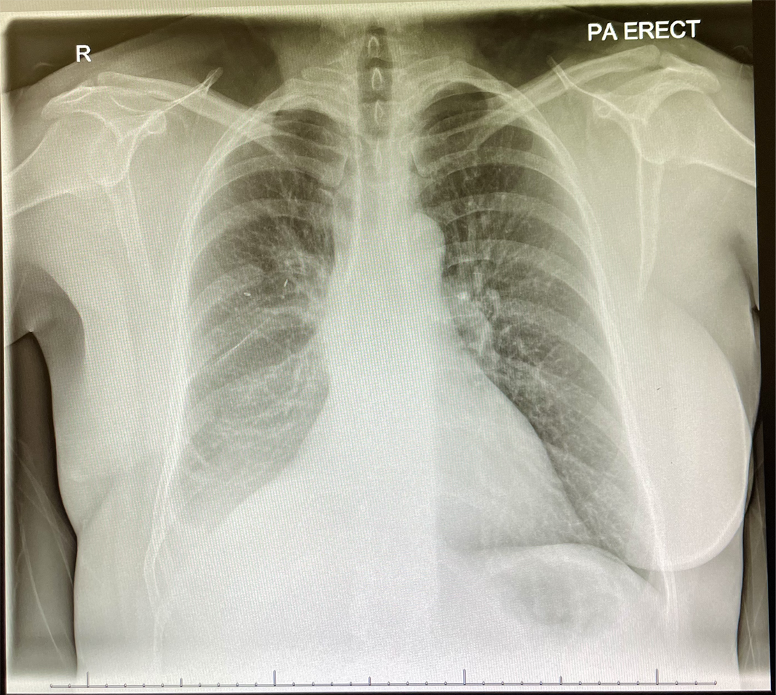 The role of 3-dimensional reconstruction imaging in bronchopulmonary ...