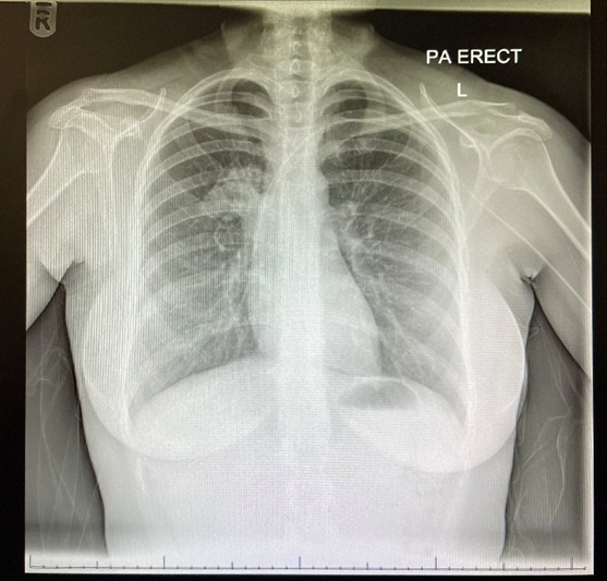 The role of 3-dimensional reconstruction imaging in bronchopulmonary ...