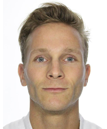 Composite LITA-RITA-Y (“LIMA-RIMA-Y”) graft configuration for coronary ...